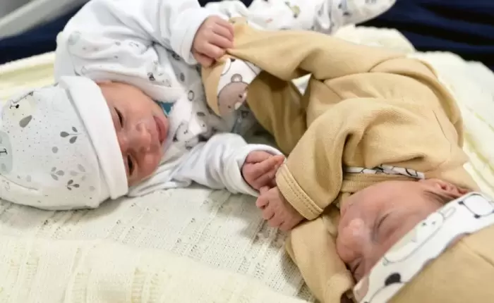 Benicio y Fabricio: los gemelos operados en el útero recibieron el alta ...